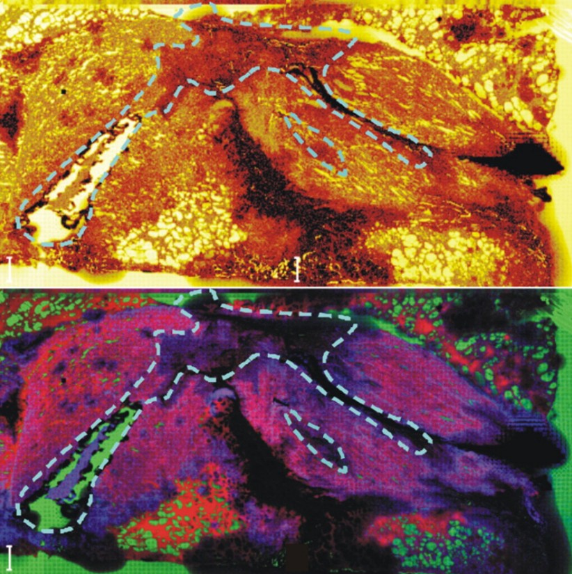 A multimodal mass spectrometry imaging approach for the study of ...