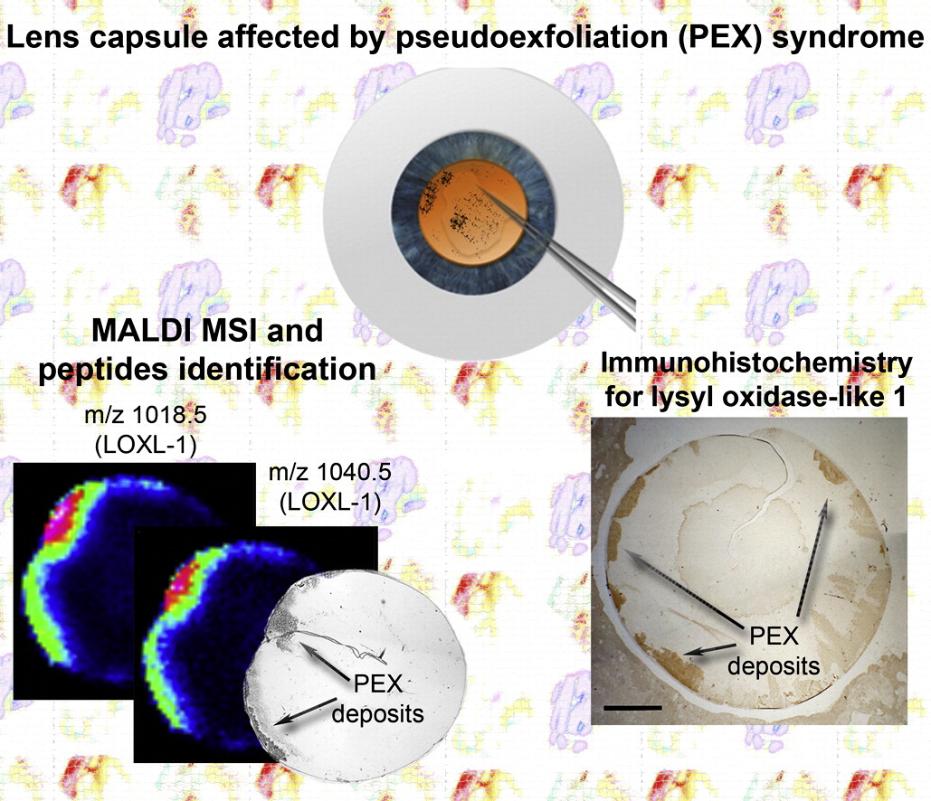 MALDI MS imaging analysis of apolipoprotein E and lysyl oxidase-like 1 ...