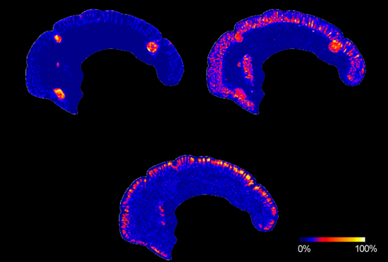 In Situ Characterization of Tissue-Resident Immune Cells by MALDI Mass ...